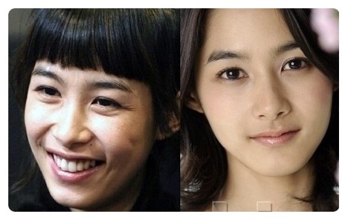 양악수술비용 양악수술 연예인 전후사진모음 강혜정 임혁필 채정안 강유미 강혜정 김지혜 이동윤 이진 이방용 신은경 양악수술
