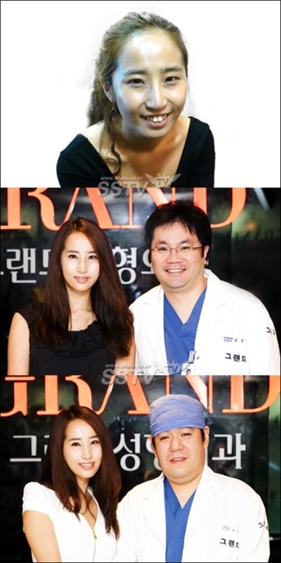 애로배우 최은 양악수술 페이스 오프 최은 다이어트 성공 S라인 몸매 슈퍼스타 K2 최은 네이버 블로그