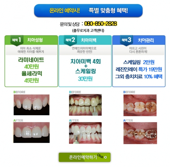 잇몸퇴축 잇몸염층치료 잇몸염층치료비용 스케일링 2만원 네이버 블로그