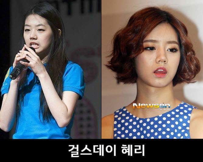 연예인 성형 전후사진 대공개 네이버 블로그
