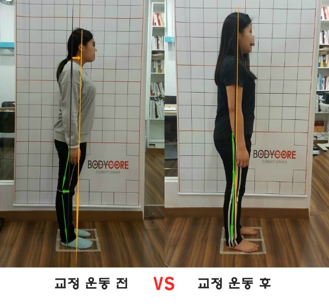 X다리교정운동으로 달라진 체형을 만나보세요 네이버 블로그